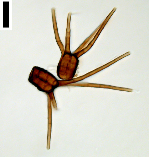 (Tetraploa)