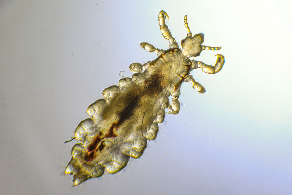 Human Louse in March 2022 by Wayne Martin · iNaturalist