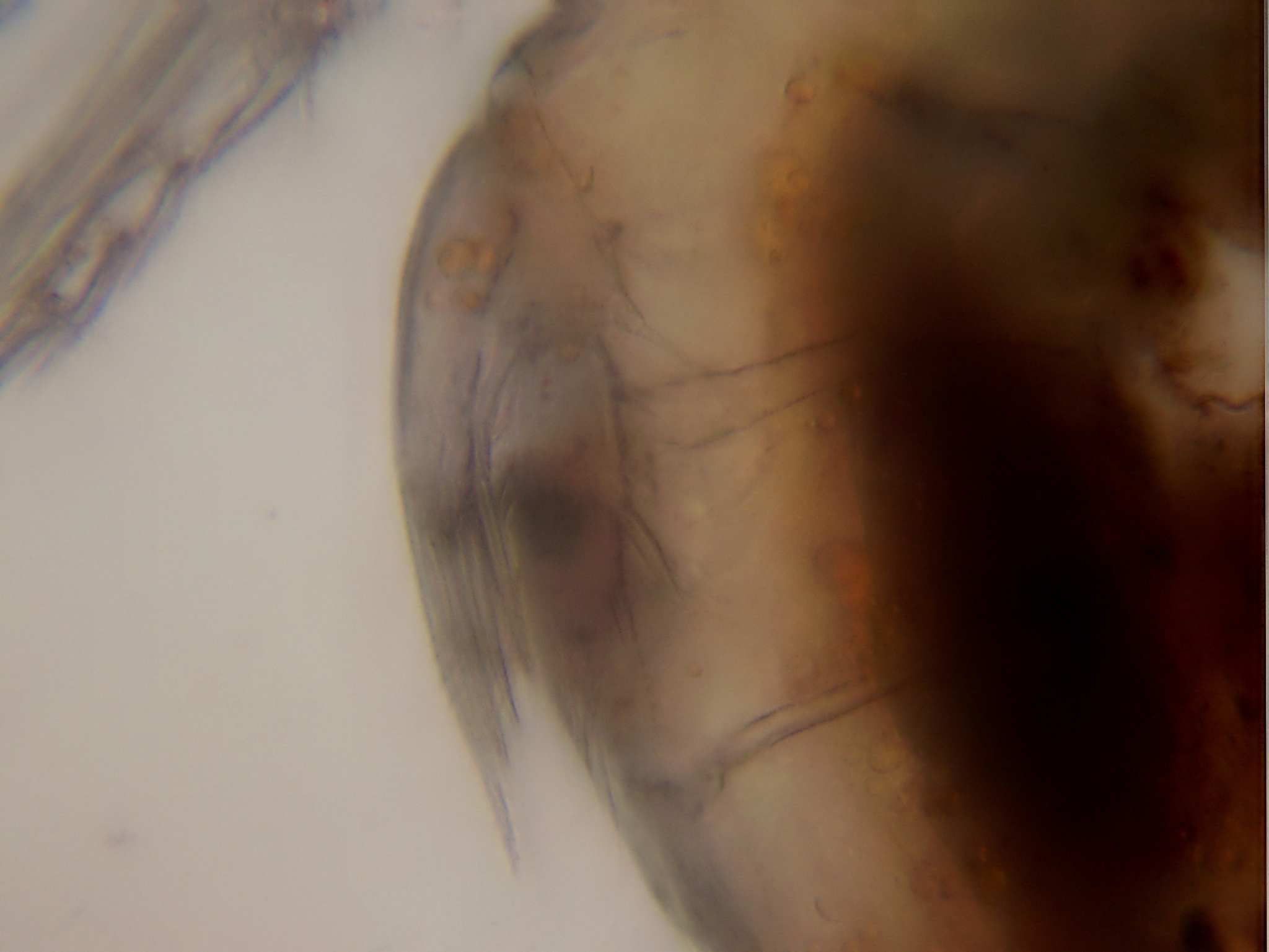 Canthocamptidae