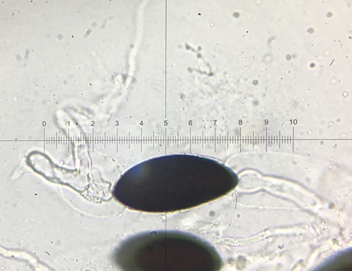 Podospora austrohemisphaerica · iNaturalist