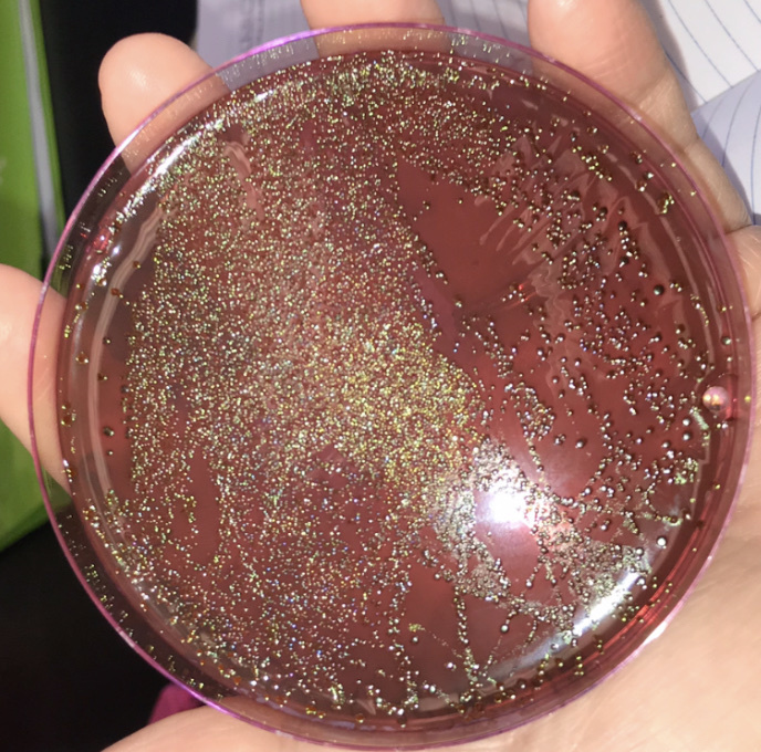 E. coli from Rock Ave, Green Brook, NJ, US on April 07, 2018 at 08:35 ...