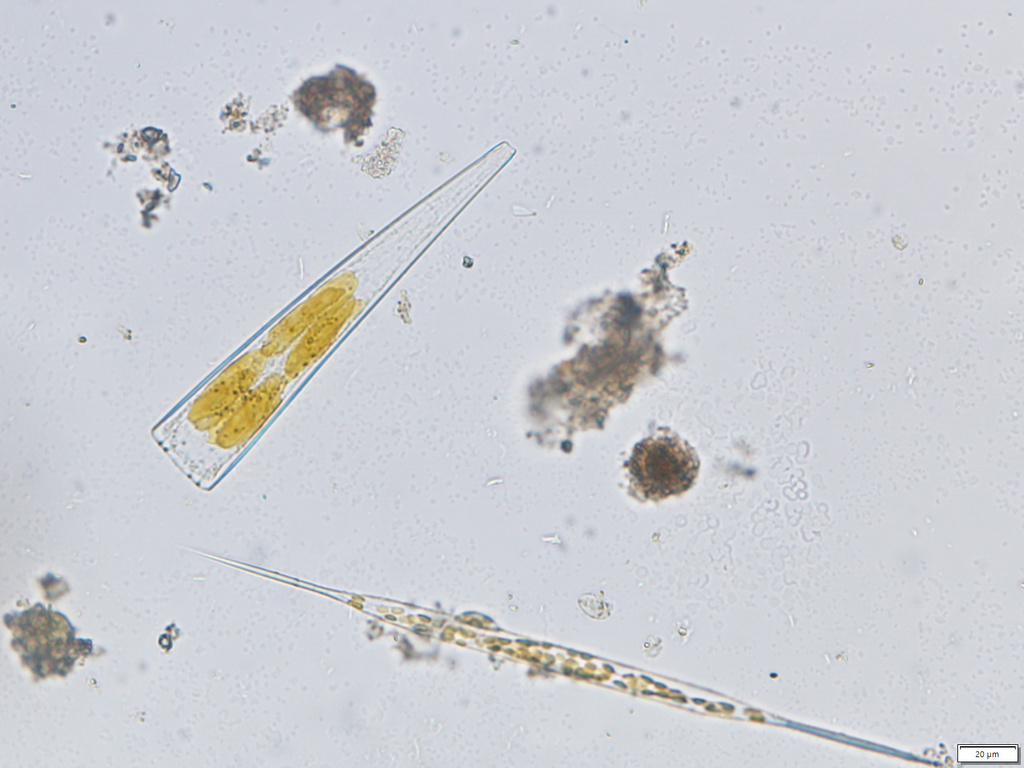 Licmophora (Guide to Marine and Freshwater Phyto- and Zooplankton of SW ...