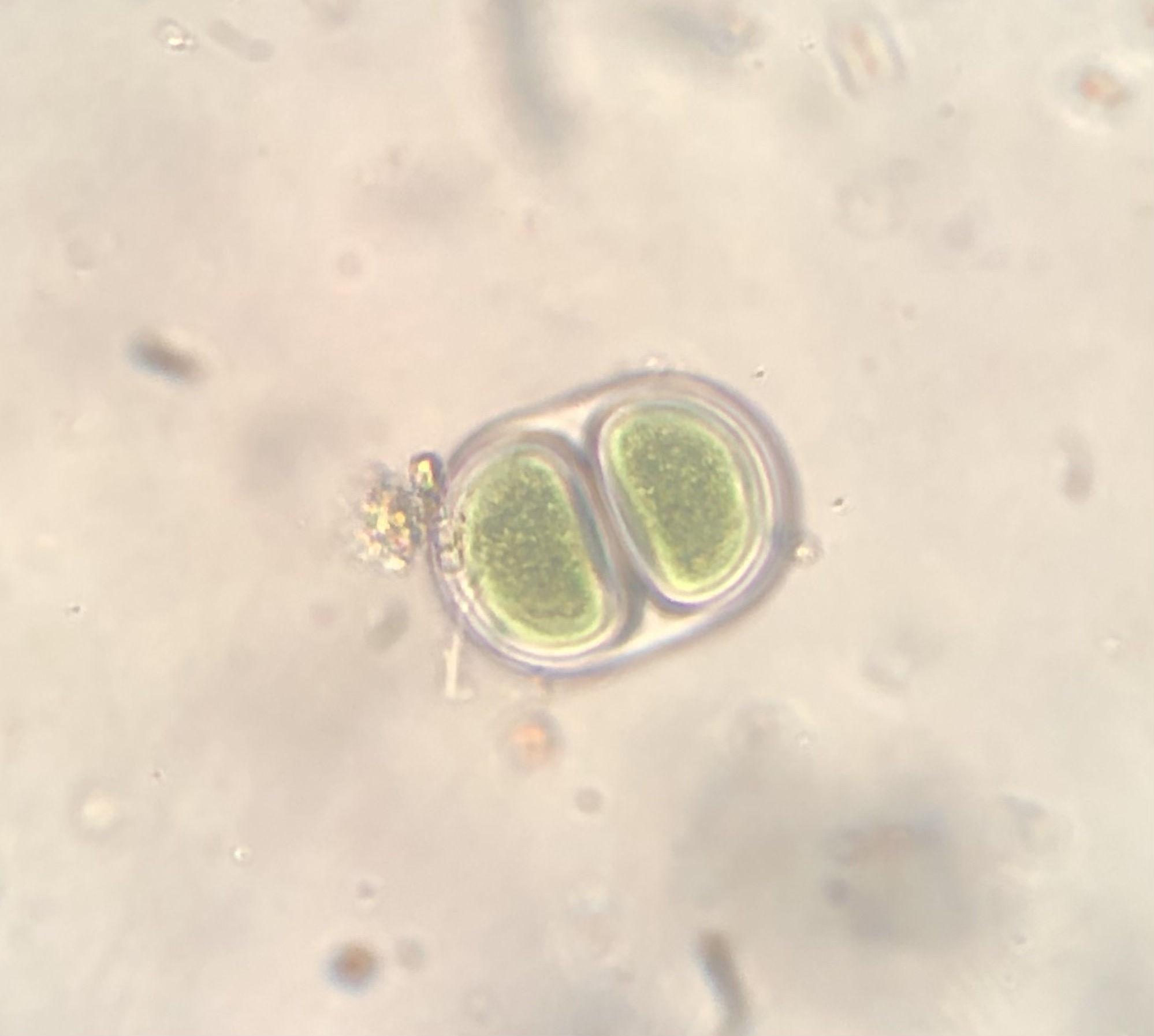 Chroococcus turgidus (Kütz.) Nägeli