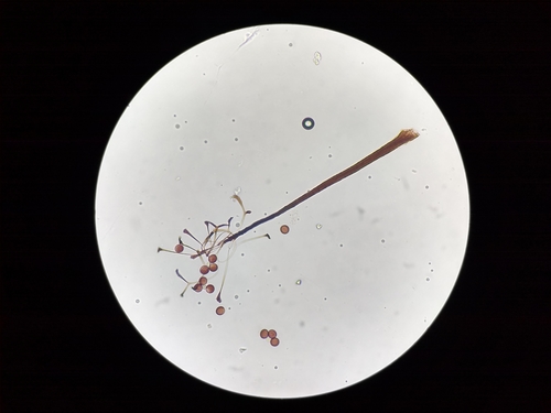 Paradiacheopsis fimbriata · iNaturalist