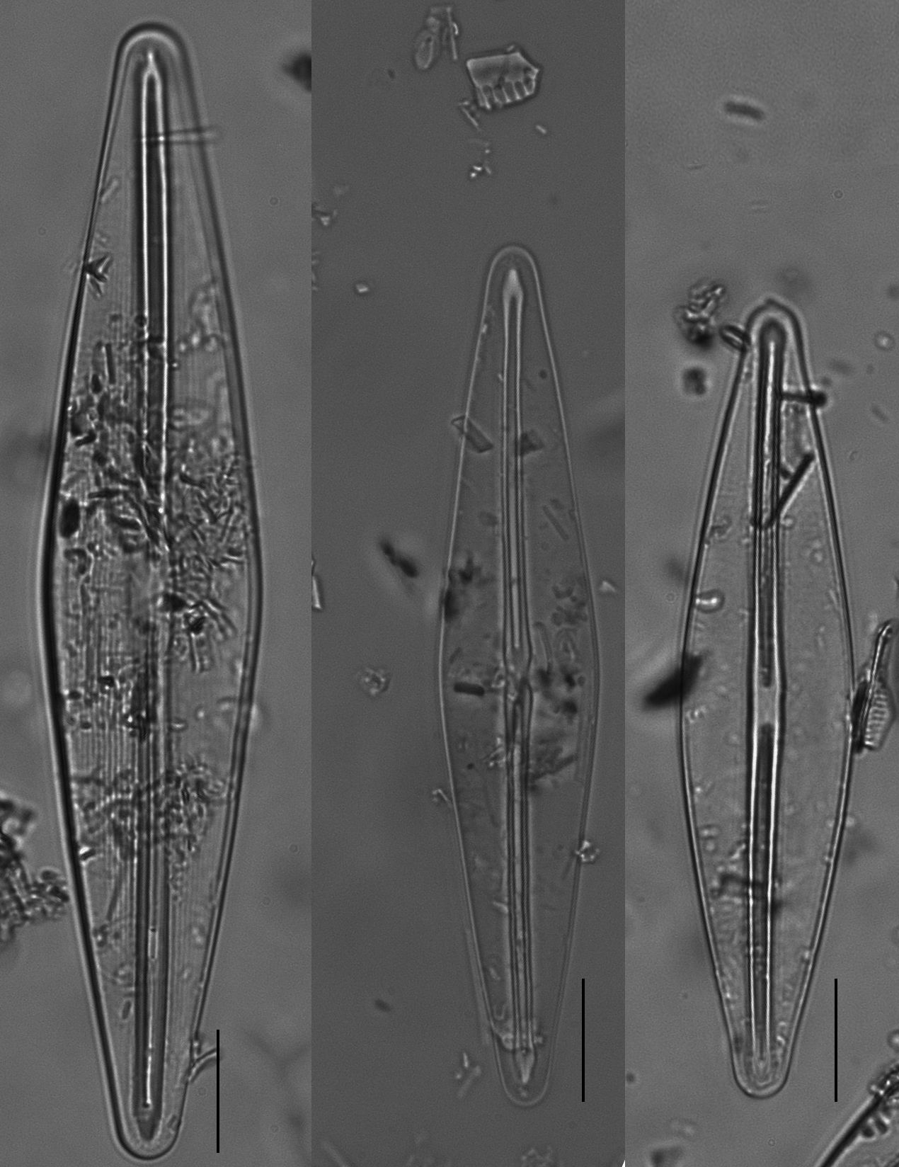 Frustulia rhomboides (Ehrenberg) De Toni, 1891