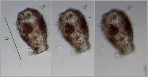 Difflugiidae (amoebas of the world) · iNaturalist