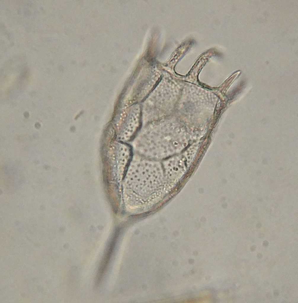 Keratella cochlearis from Westdene, Benoni, 1501, South Africa on April ...