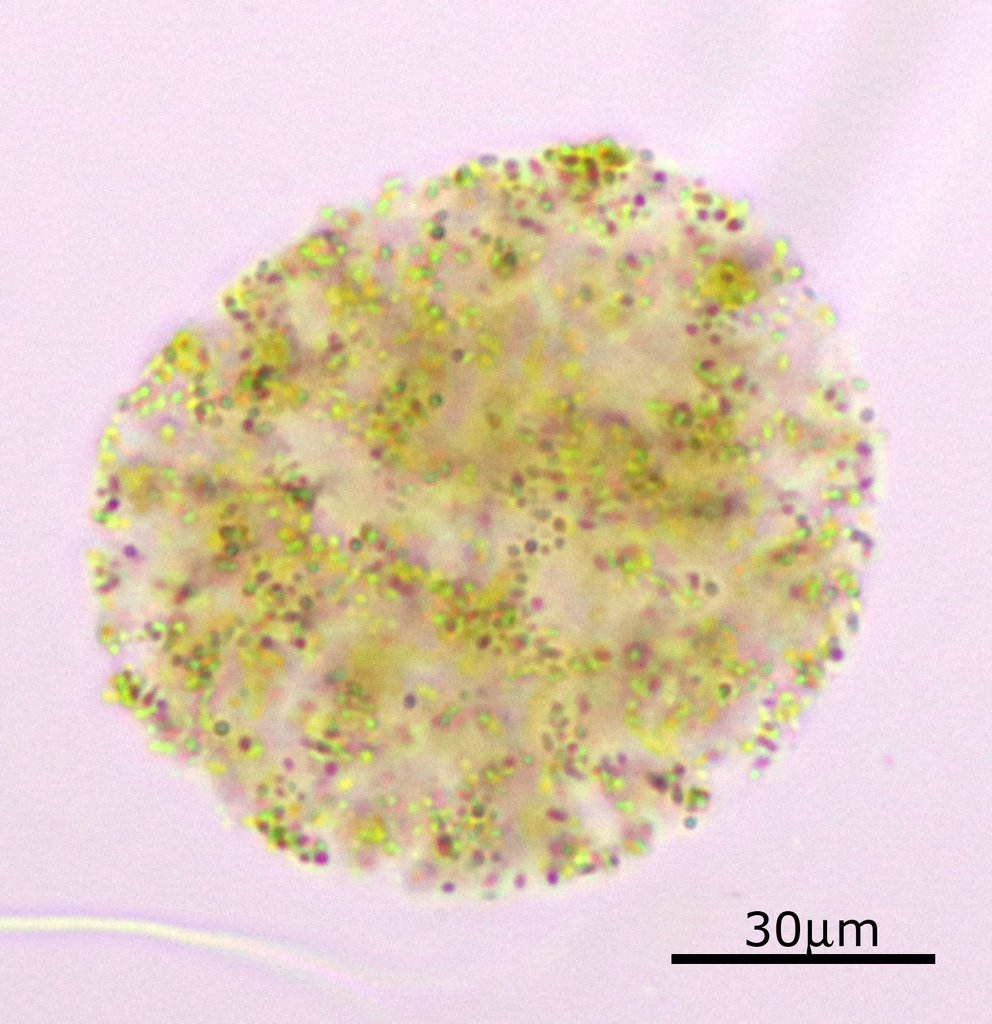 Chlorobiaceae from Dunbar-Manhattan Heights, Lubbock, TX, USA on May 27 ...