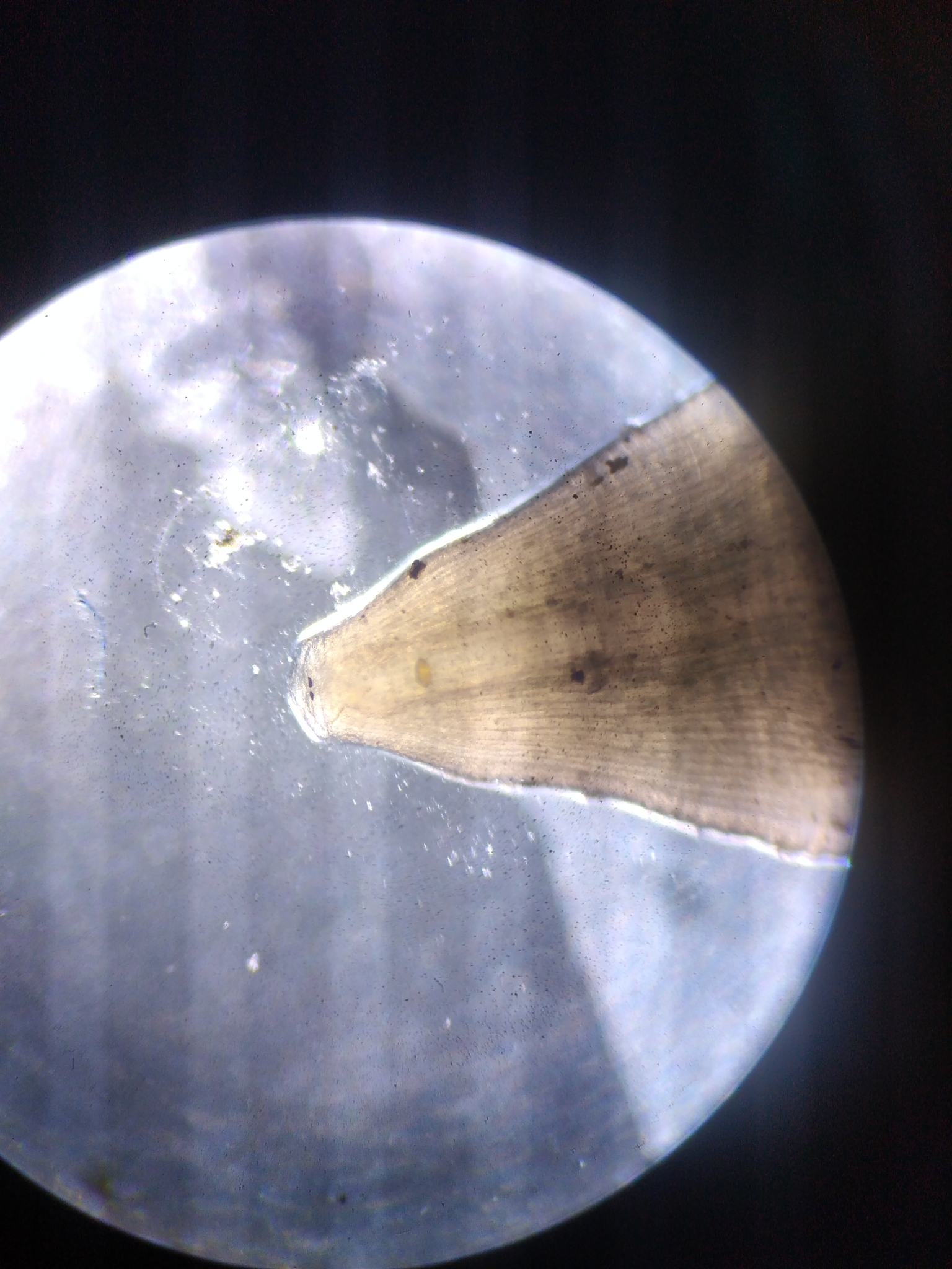 Helobdella stagnalis (Linnaeus, 1758)