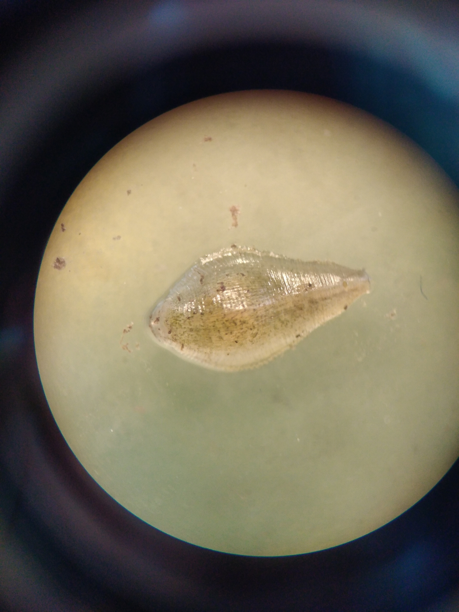 Helobdella stagnalis (Linnaeus, 1758)