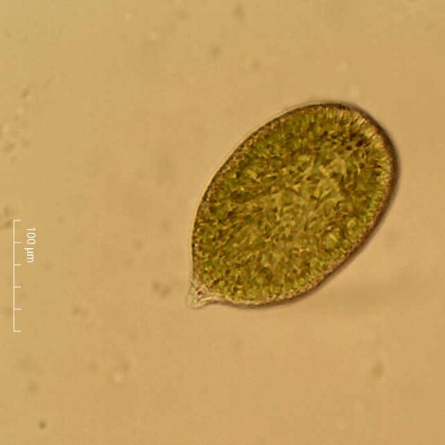 Gonyostomum semen (Ehrenb.) Diesing