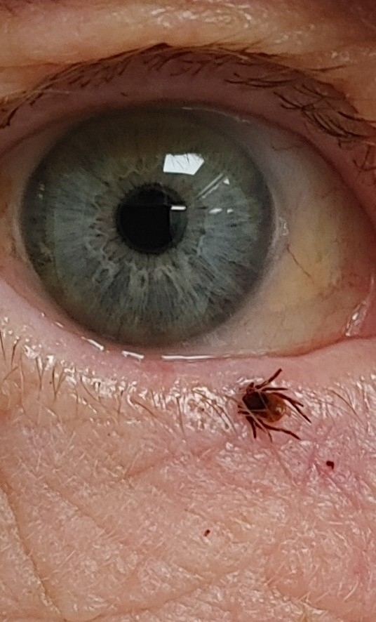 Eastern Black-legged Tick from Belle Park on June 11, 2022 at 12:15 AM ...