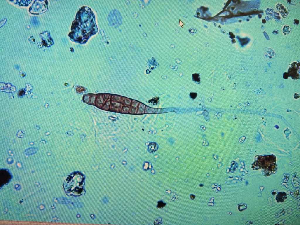 Alternaria alternata from Juriquilla, Qro., México on June 14, 2022 at ...