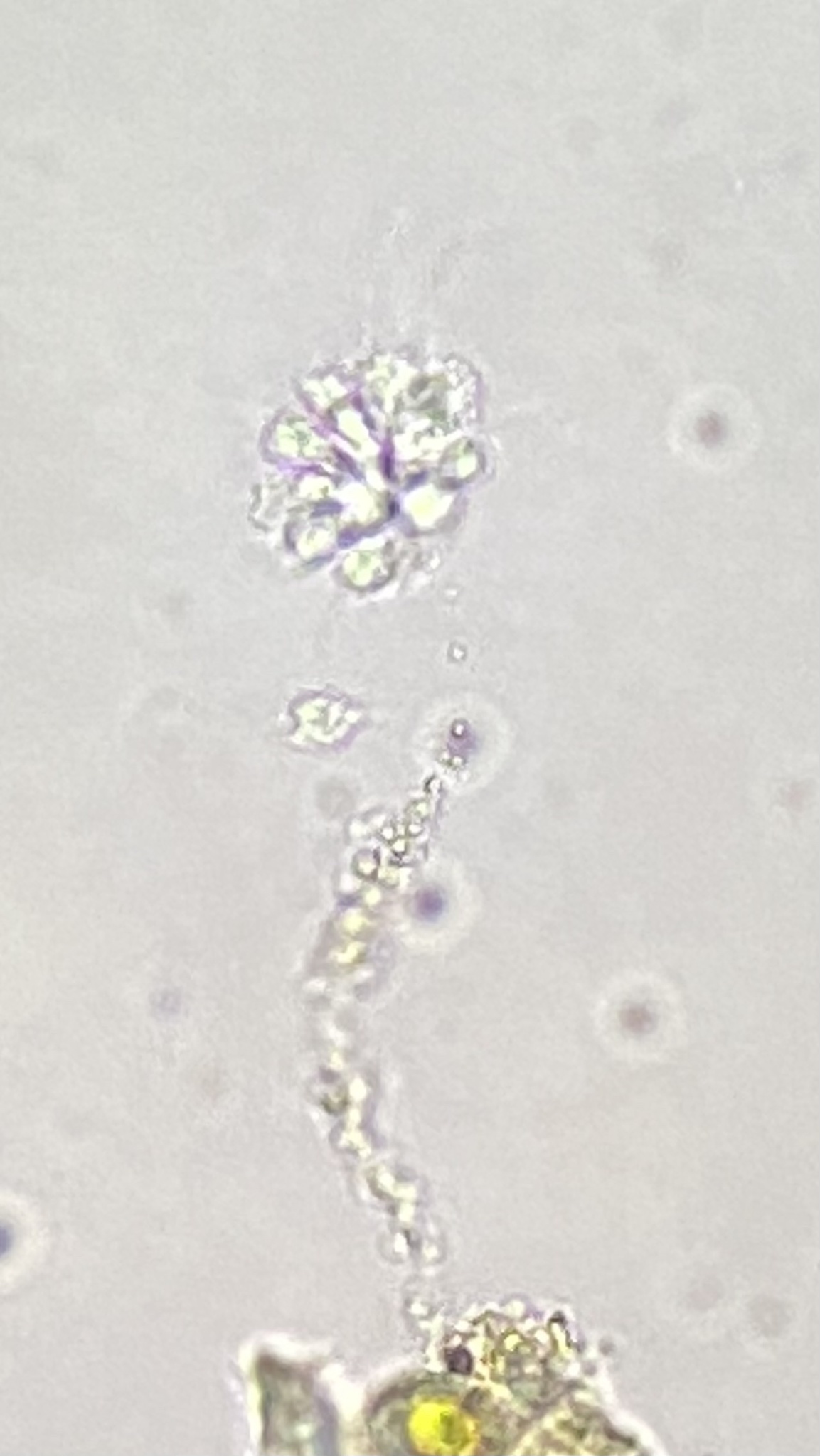 Anthophysa vegetans (O.F.Müller) Stein, 1878