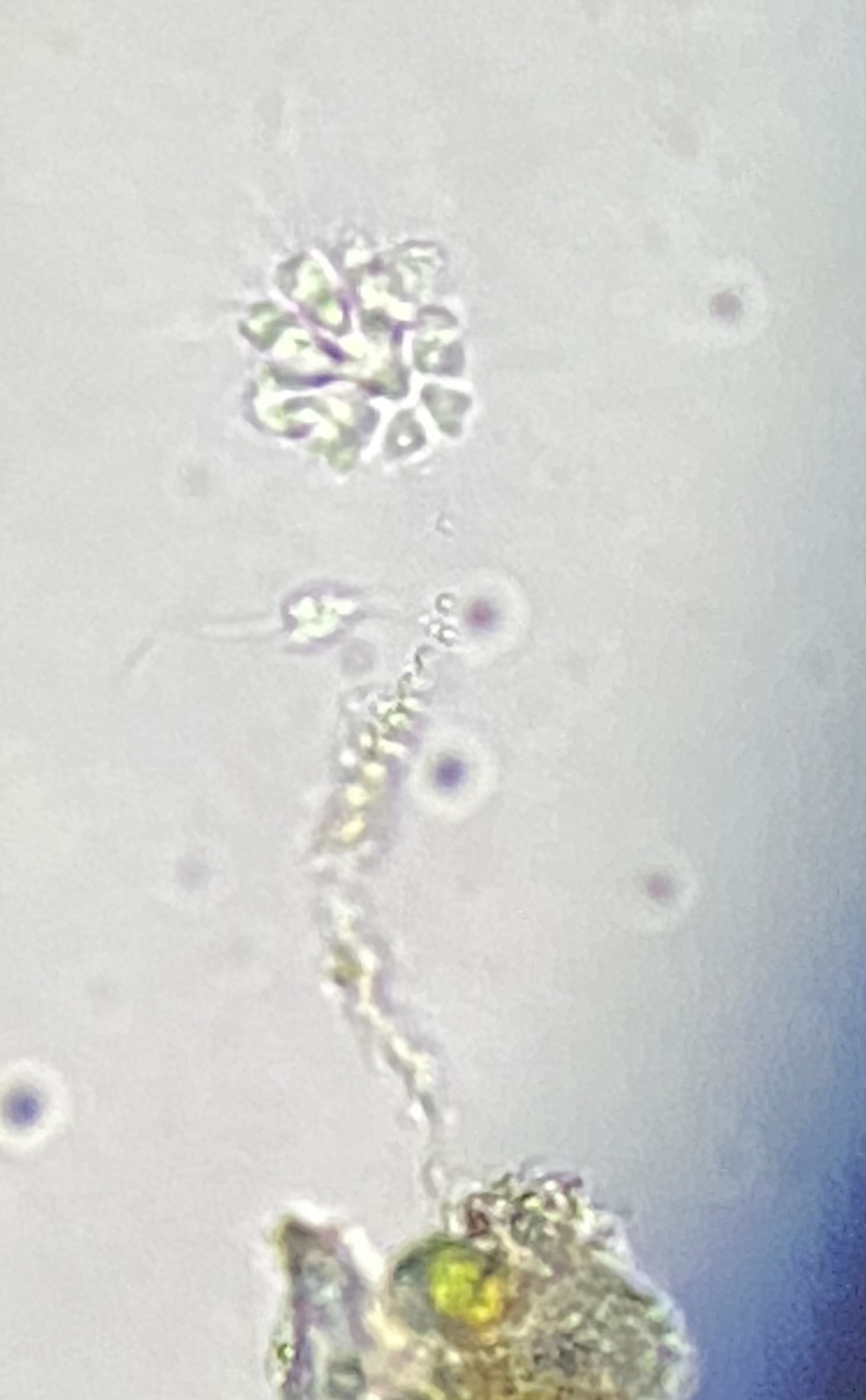 Anthophysa vegetans (O.F.Müller) Stein, 1878