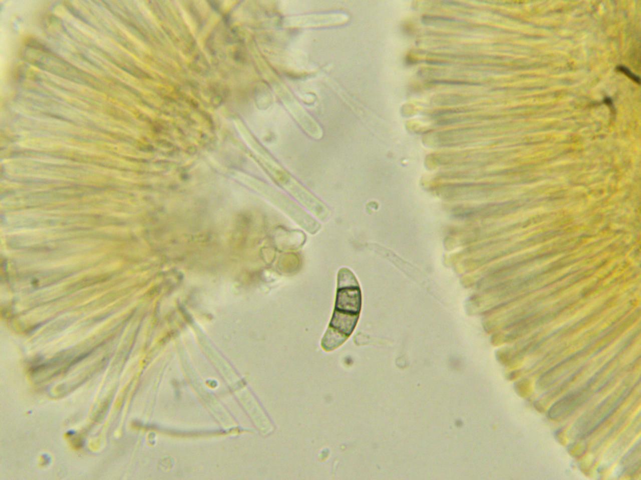 Orbilia xanthostigma (Fr.) Fr.