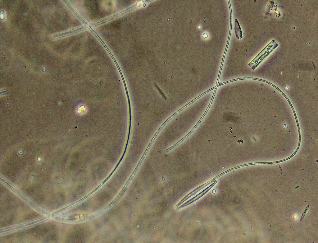 Limnothrix redekei from Fort McMurray, AB, Canada on June 23, 2022 at ...