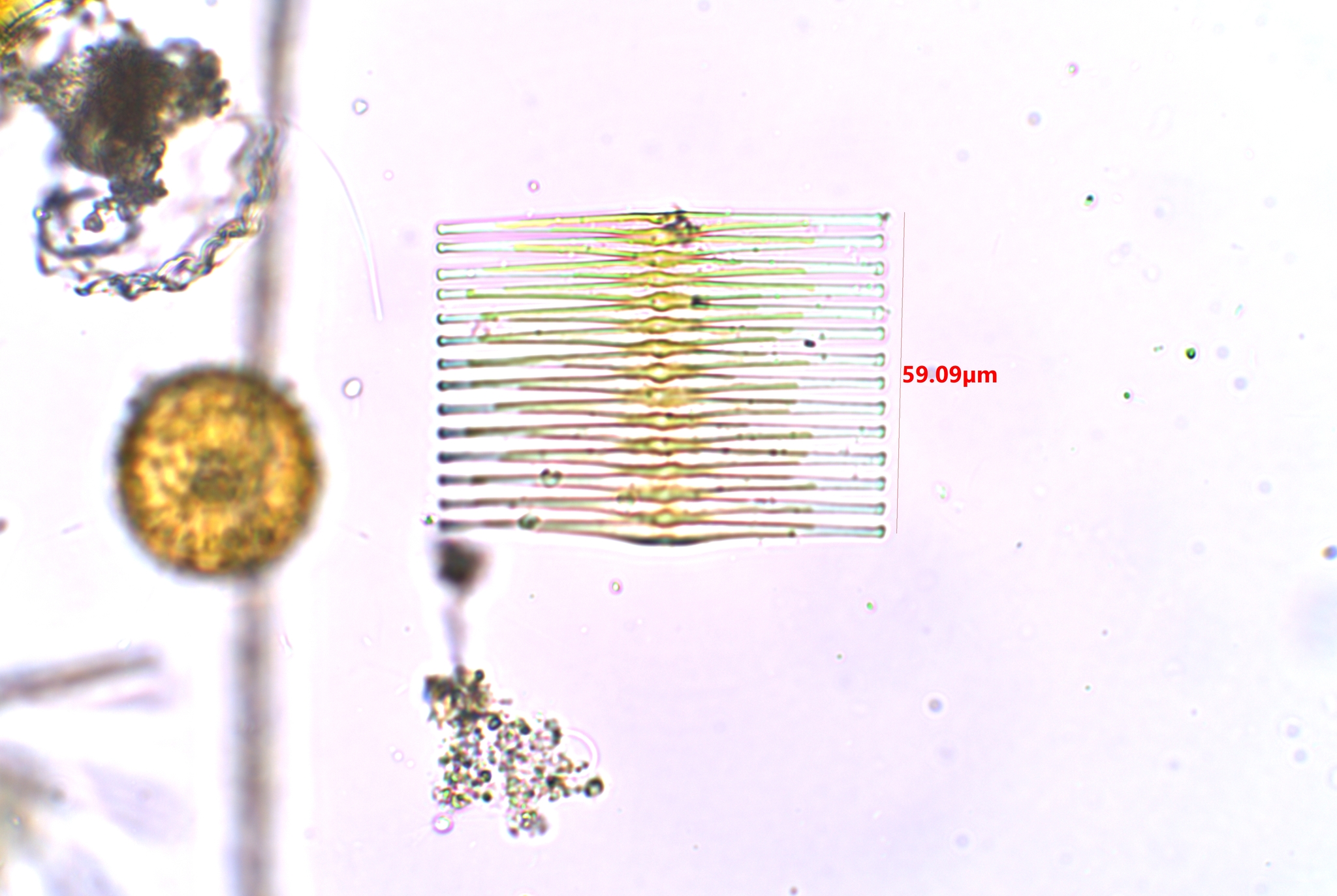 Fragilaria crotonensis Kitton, 1869