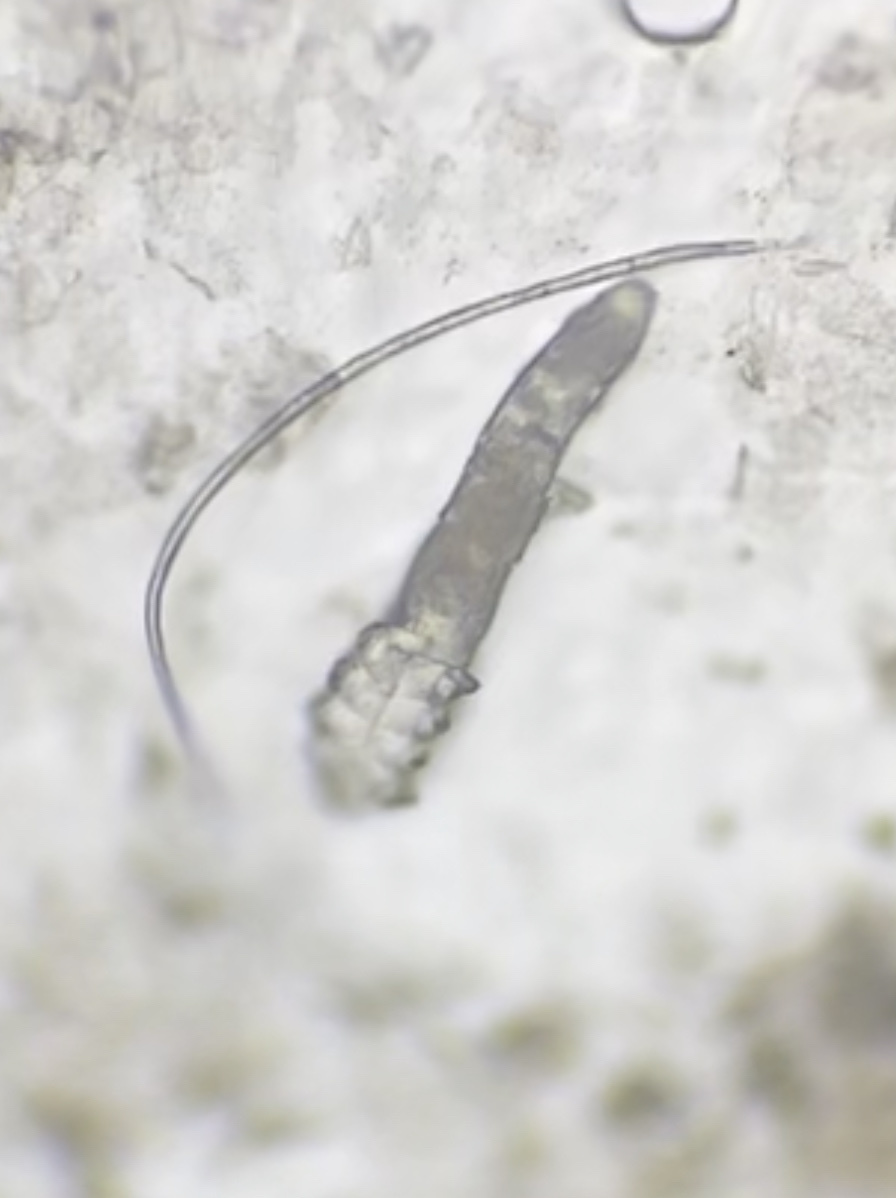 Demodex folliculorum (Simon, 1842)