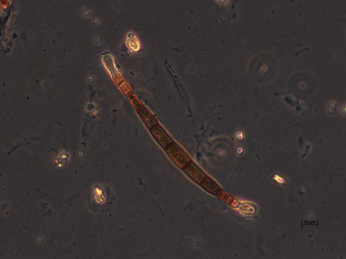 Xylomyces aquaticus · iNaturalist