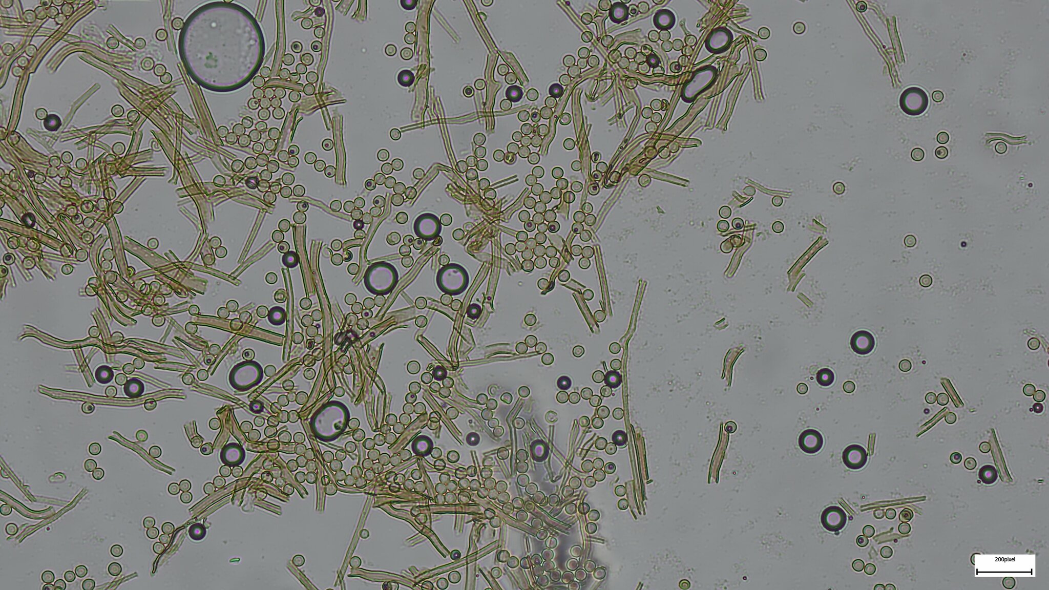 Lycoperdon dermoxanthum Vittad.