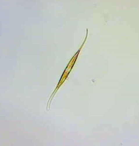 (Nitzschia longissima)