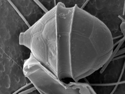 Fitoplancton (Scrippsiella trochoidea)