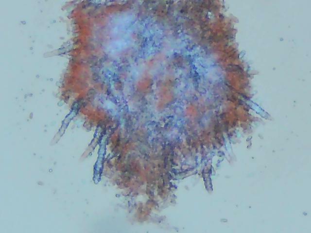 Hyphoderma setigerum (Fr.) Donk