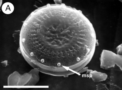 Cyclotella pseudostelligera · iNaturalist