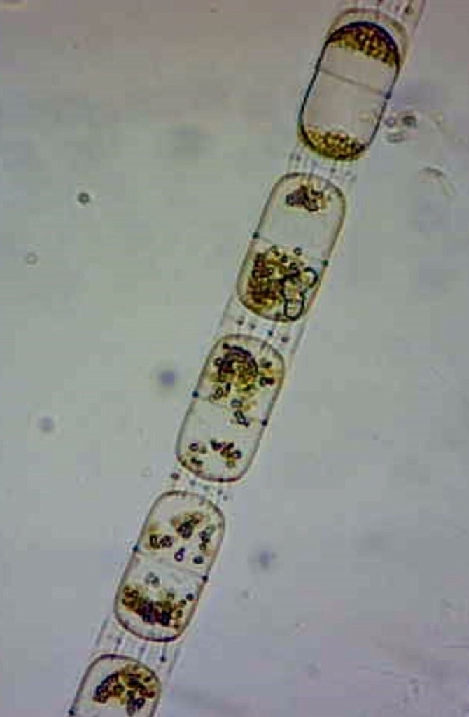 Stephanopyxis palmeriana (Encyclopedia of Diatoms Found in the USA ...
