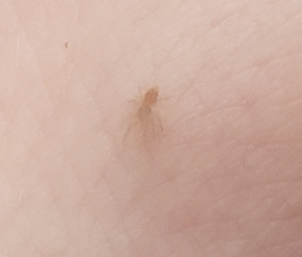 Typical Spiders from Gander, NL A1V 1H6, Canada on August 4, 2022 at 12 ...