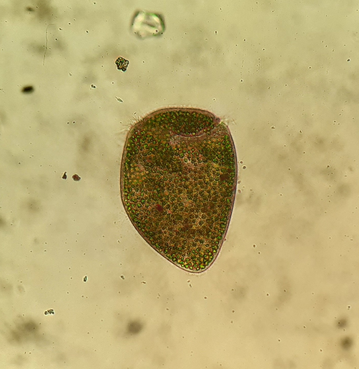Stentor amethystinus Leidy, 1880