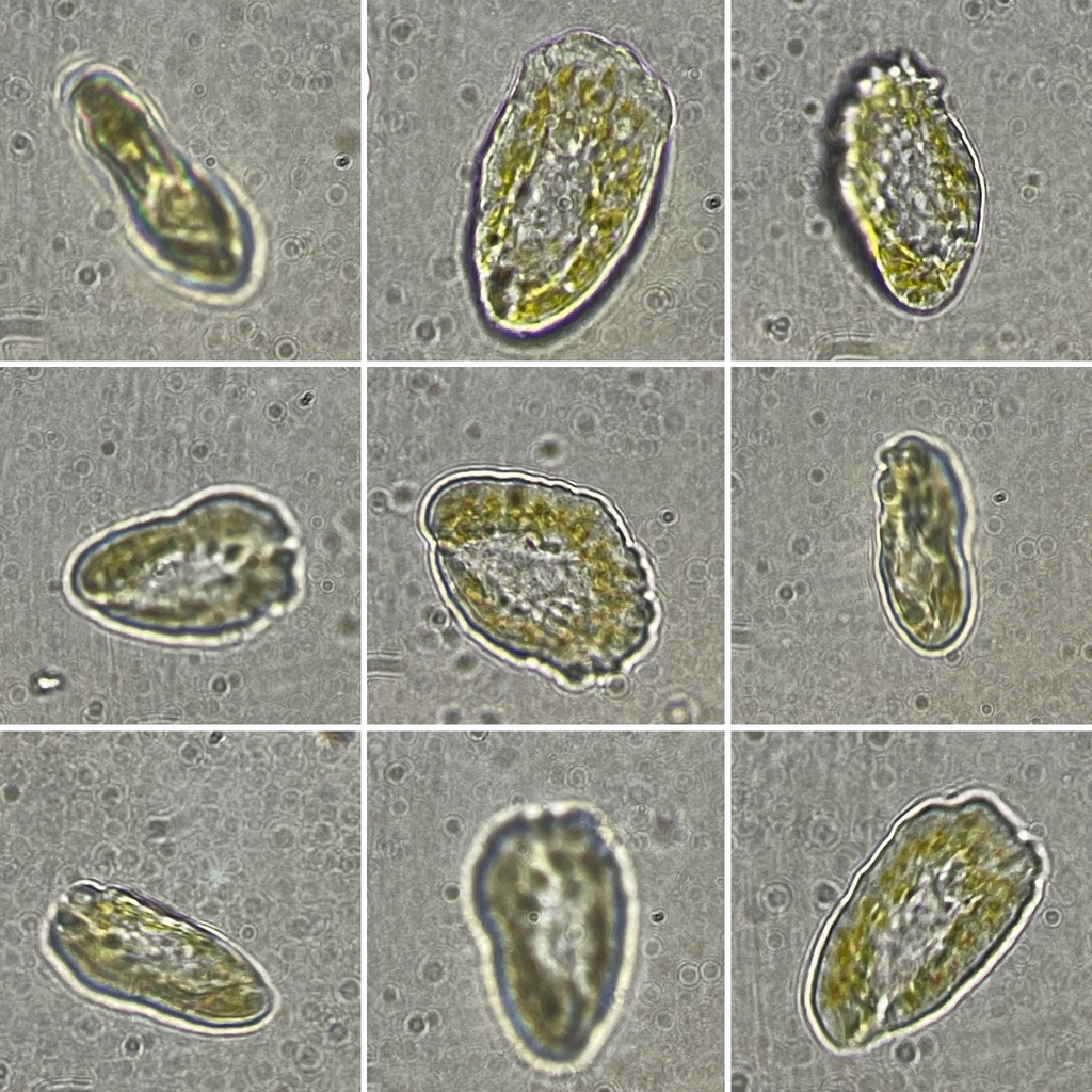 Heterosigma akashiwo from San Leandro Marina, San Leandro, CA, US on ...