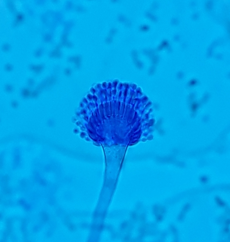 Aspergillus Fumigatus