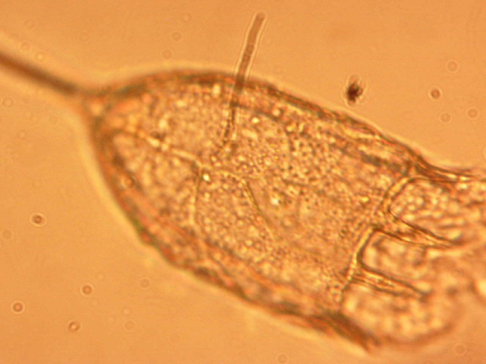 Keratella cochlearis (Gosse, 1851)