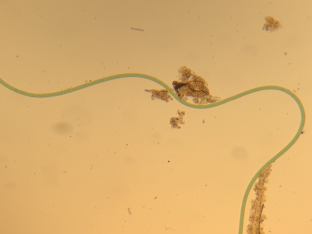 Oscillatoria from Turtle Pond, Boston MA on August 24, 2022 by scope ...