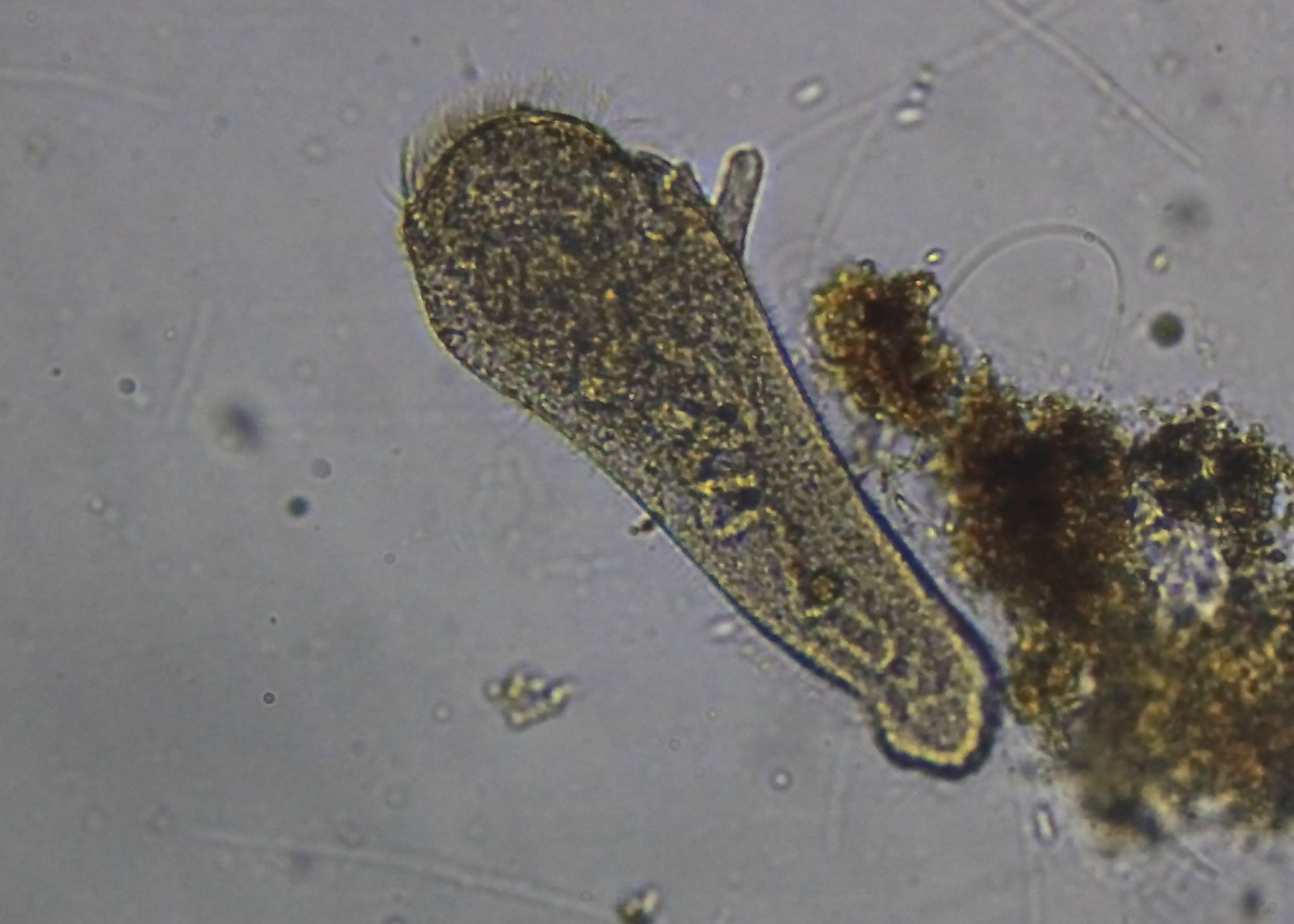 Stentor roeselii Ehrenberg, 1835