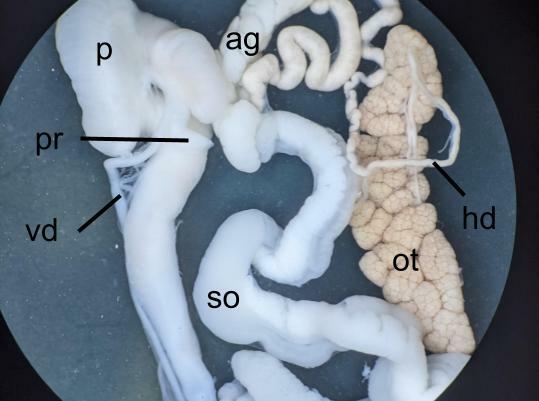 Apple Peel Atresia Usmle