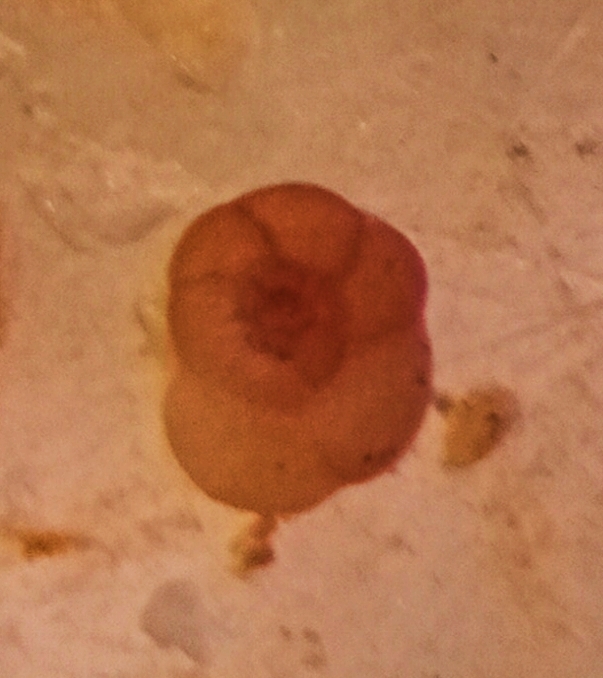 Trochammina inflata from Northland, New Zealand on September 02, 2022 ...