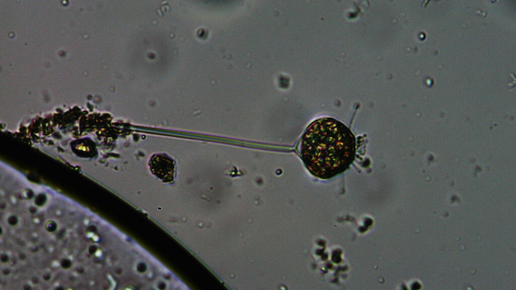 Suctoria in August 2022 by someplant. Magnification of photos: 200× ...