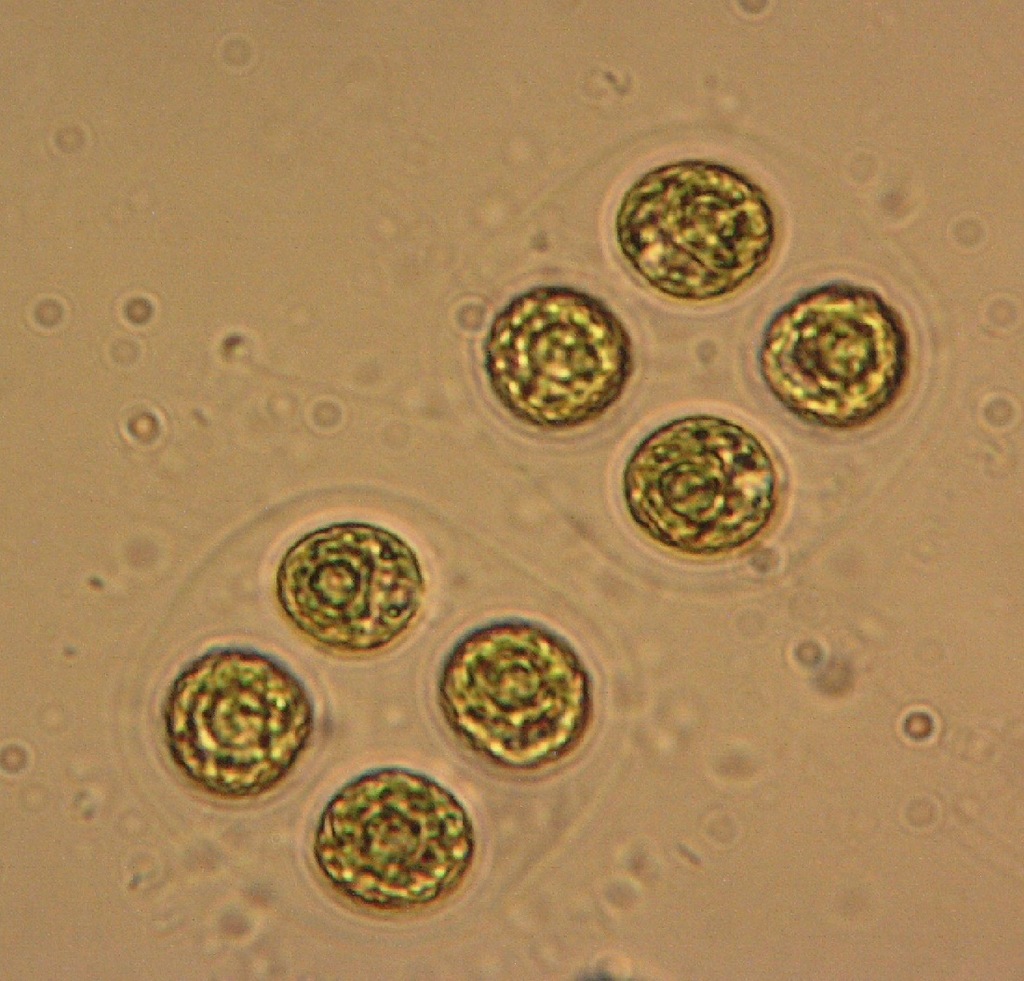 (Chlamydocapsa planctonica) - Botanical Realm