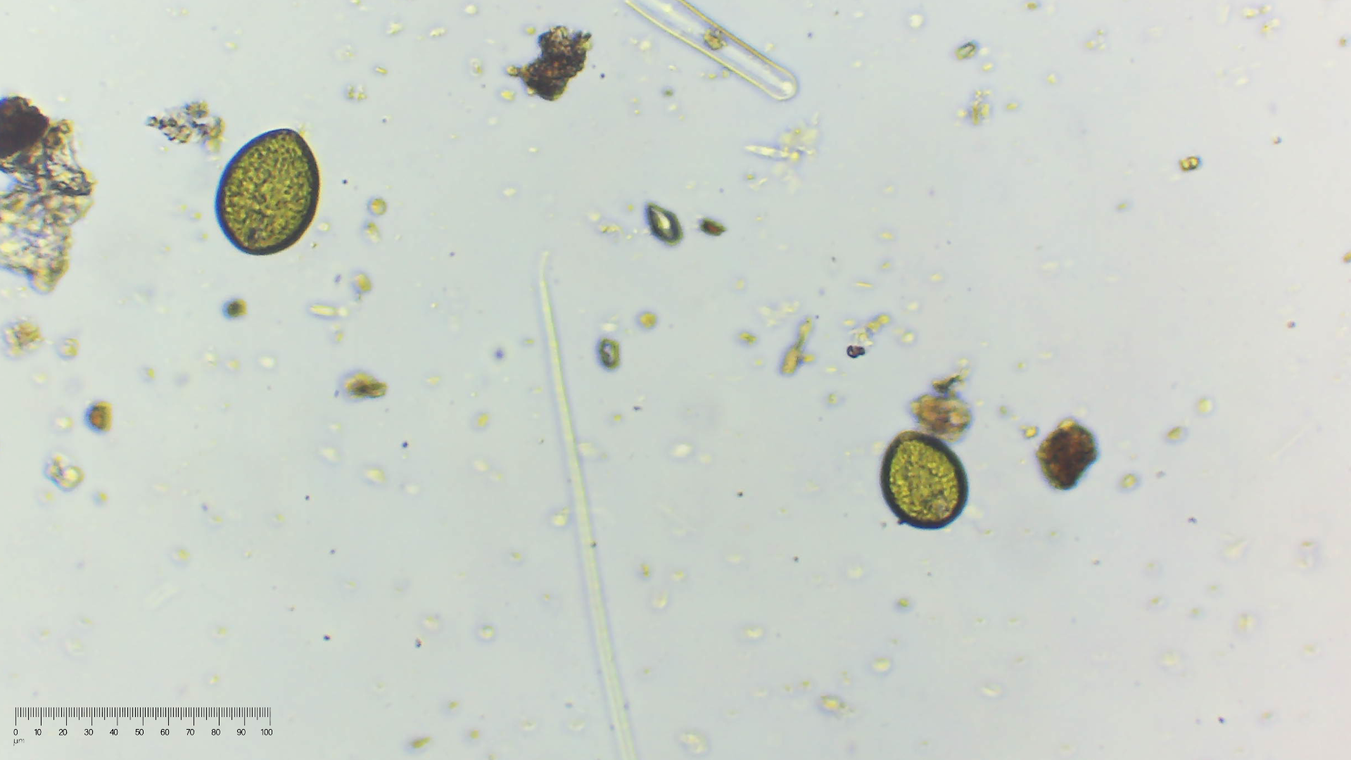 Gonyostomum semen (Ehrenb.) Diesing