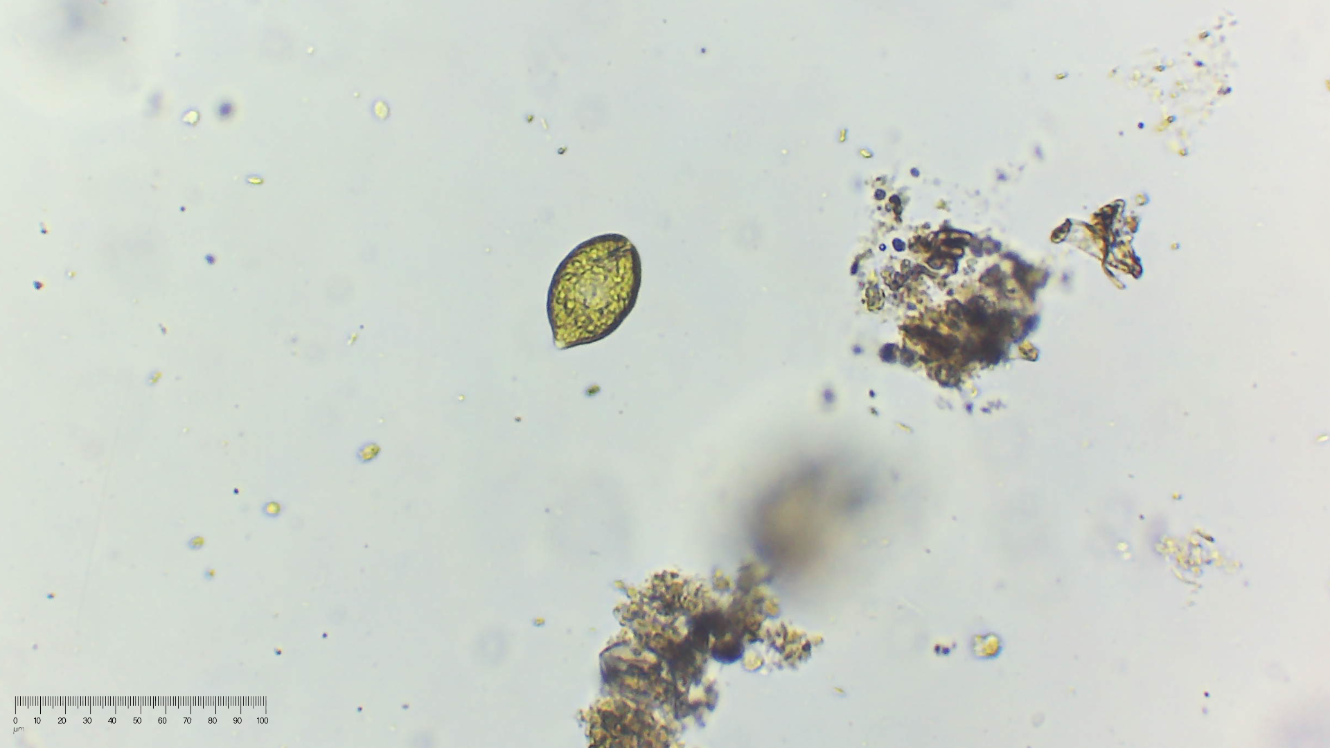 Gonyostomum semen (Ehrenb.) Diesing