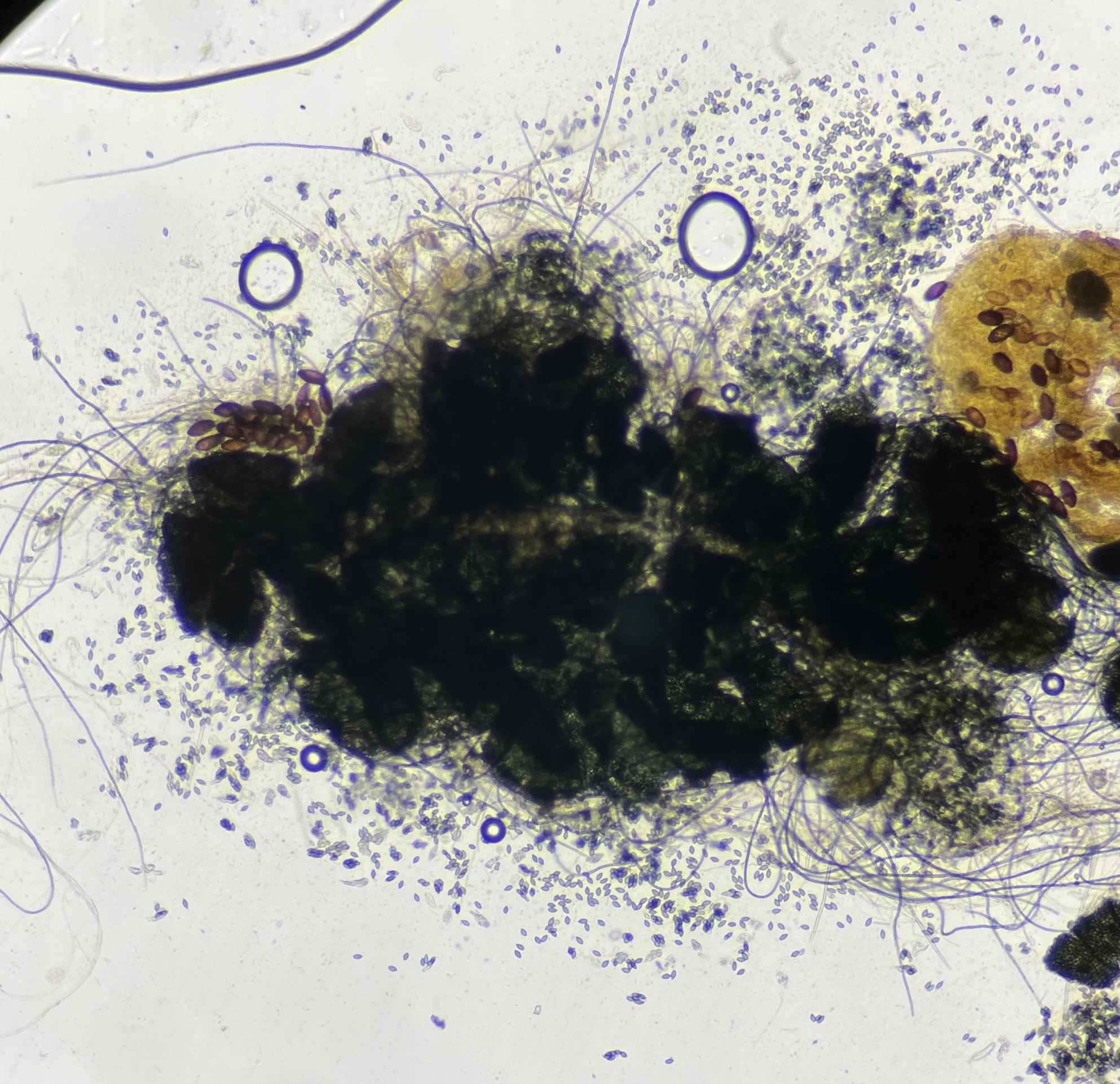 Zopfiella G.Winter, 1884