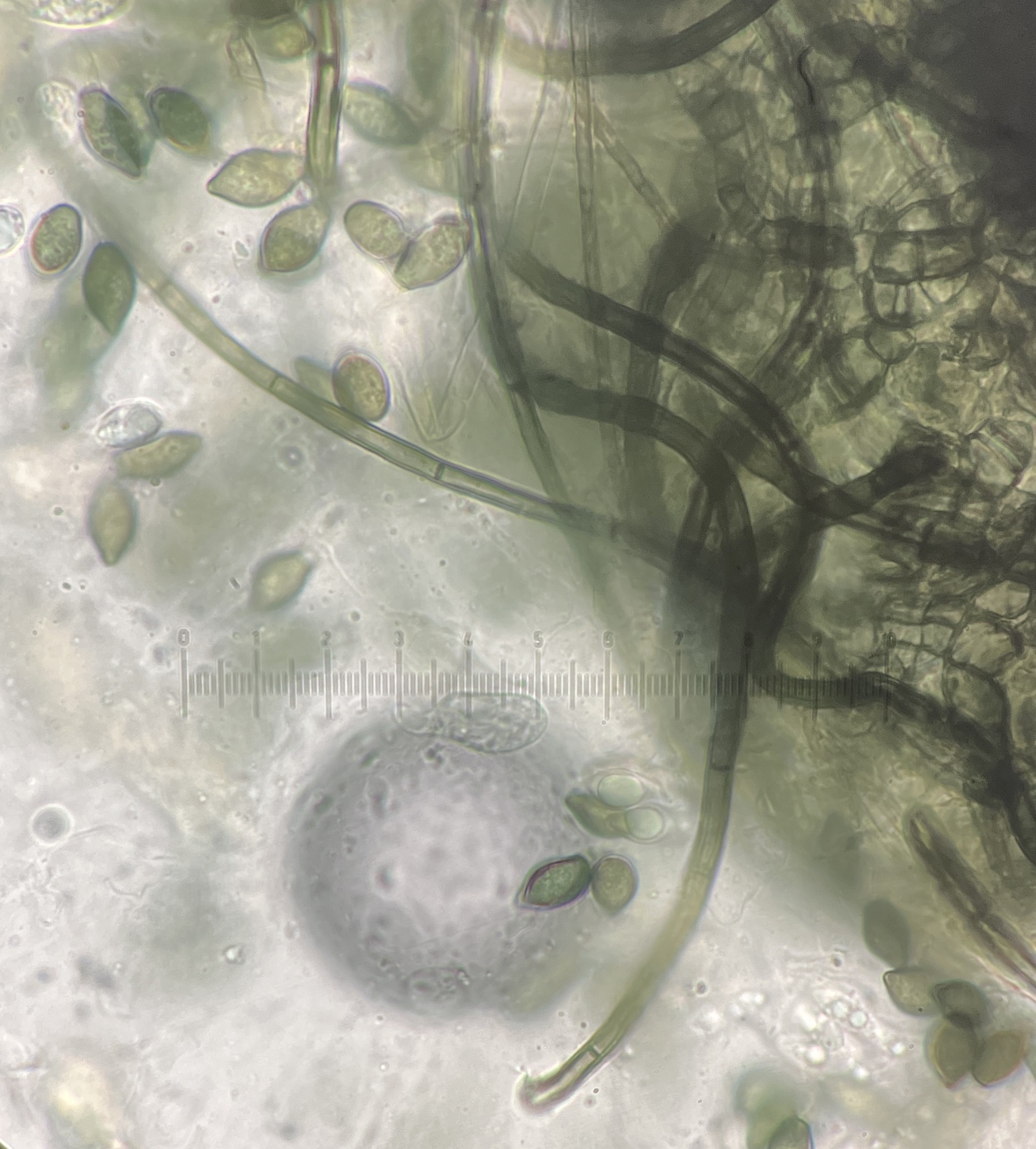 Zopfiella G.Winter, 1884