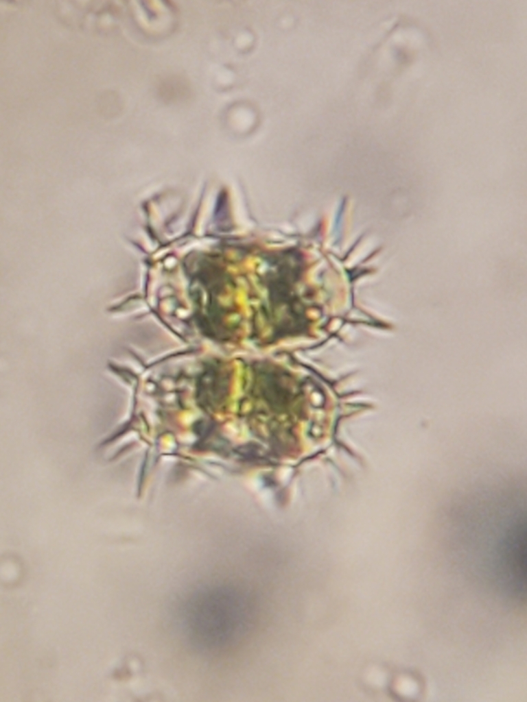 Xanthidium from Sitka, AK 99835, USA on September 14, 2022 at 05:52 PM ...