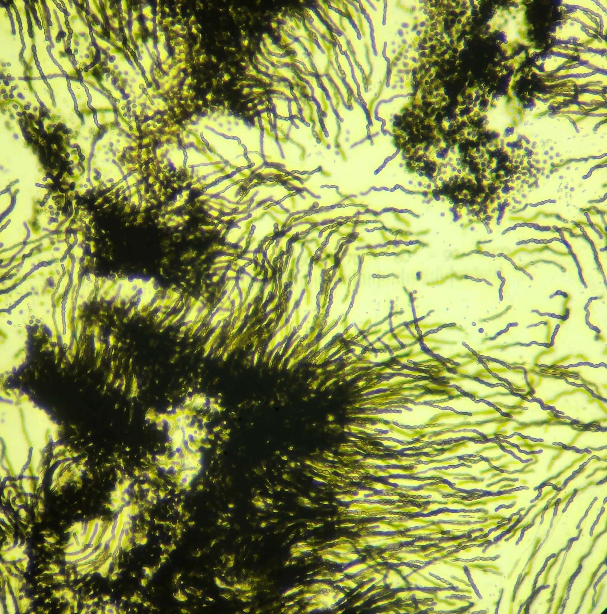 Aureobasidium pullulans (de Bary & Löwenthal) G.Arnaud