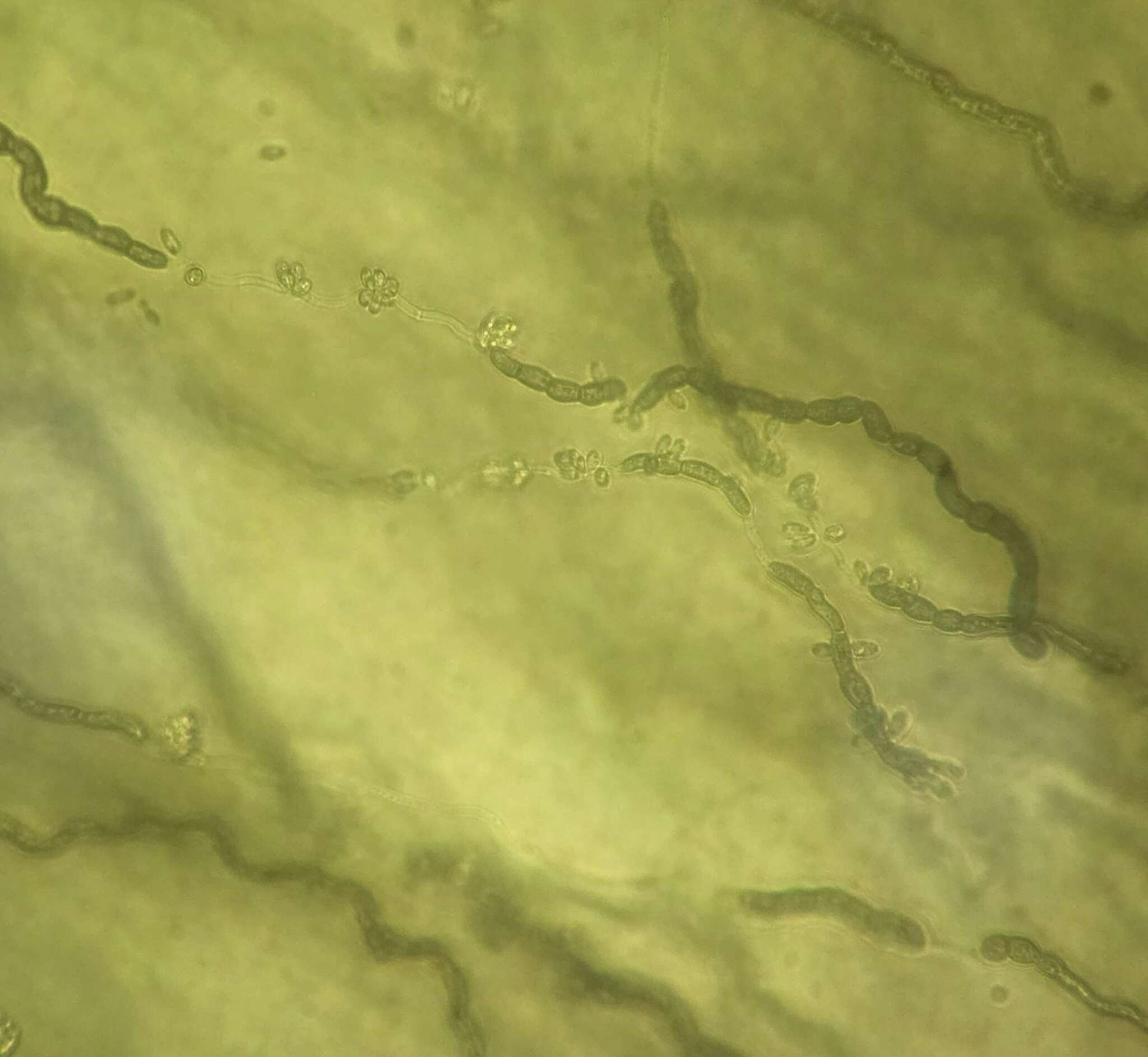 Aureobasidium pullulans (de Bary & Löwenthal) G.Arnaud