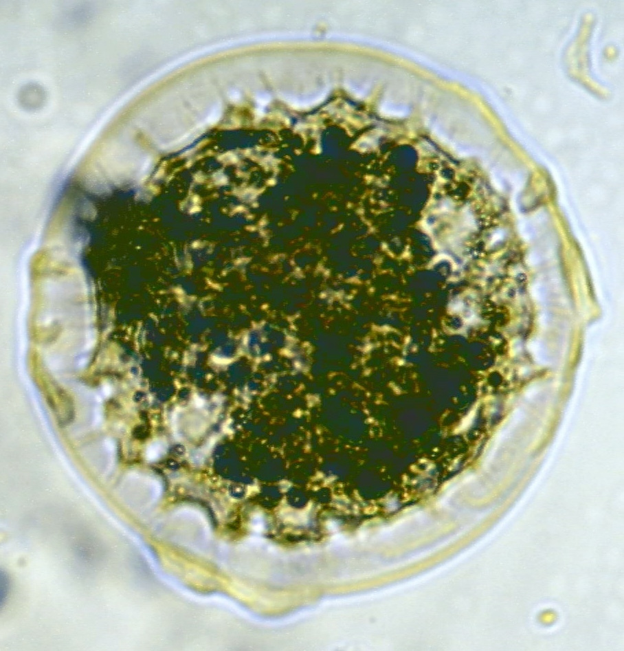 Arcella vulgaris (Arcella) · iNaturalist