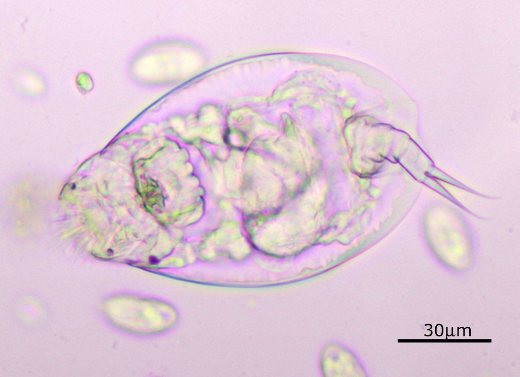 Lepadella ovalis from Clapp Park, Lubbock, TX, USA on September 24 ...